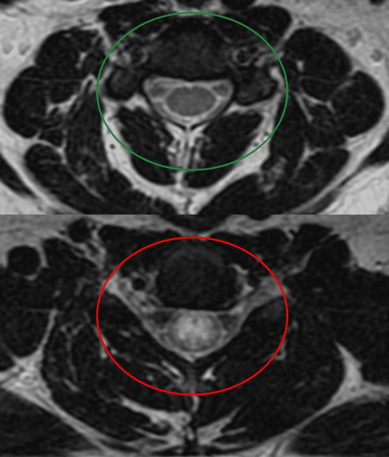 Medical Malpractice Lawsuit Filed Against WellStar Kennestone Hospital ...